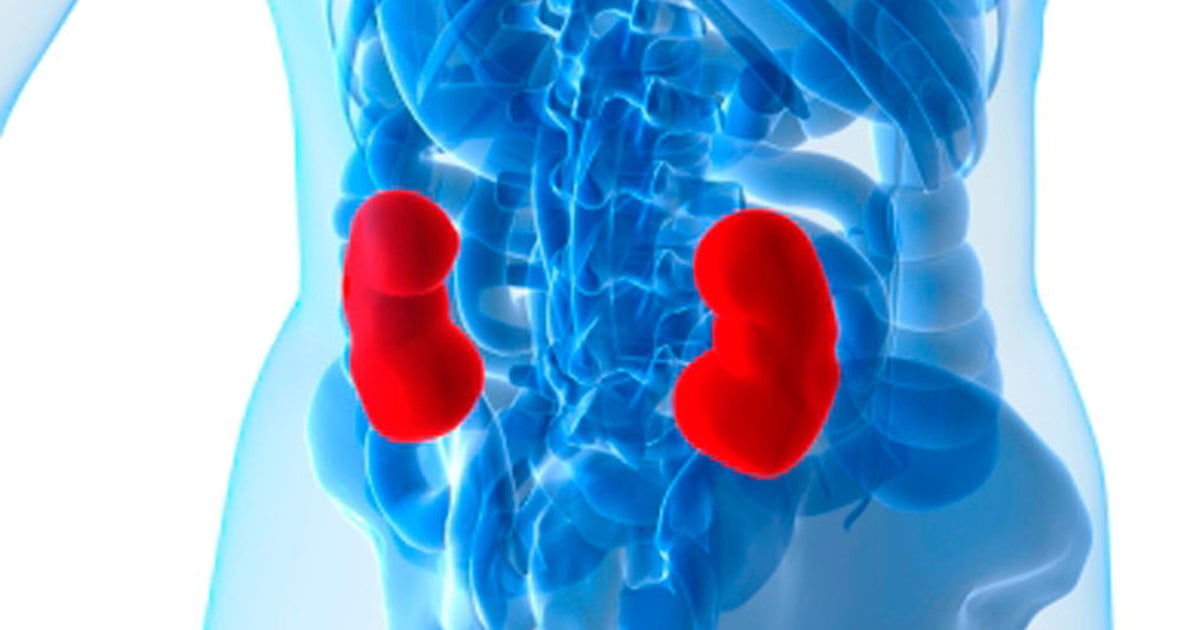 Paying $10,000 for kidney donation may reduce medical costs, increase ...