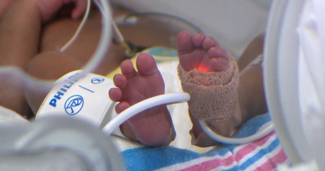 Boys more likely to be born prematurely - CBS News