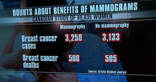 Mammogram study: Test doesn't save lives of women 40-59 - CBS News