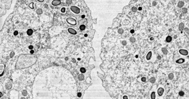 Ancient virus resurrected after 30,000 years, scientists say - CBS News