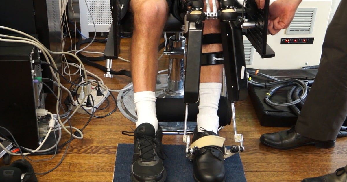 How robotic rehab may help young stroke victim reclaim future - CBS News