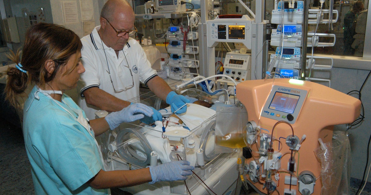 Doctors design mini dialysis machine for babies - CBS News