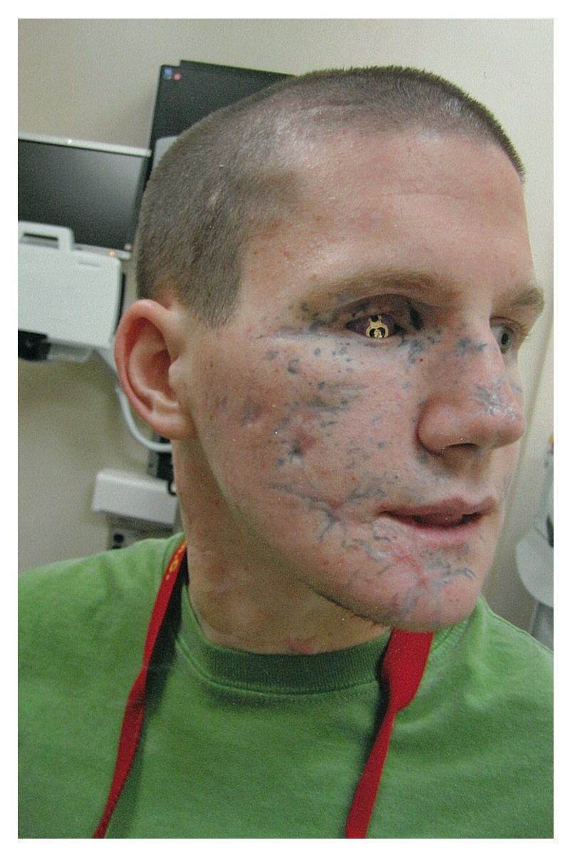 Kyle Carpenter, an American hero