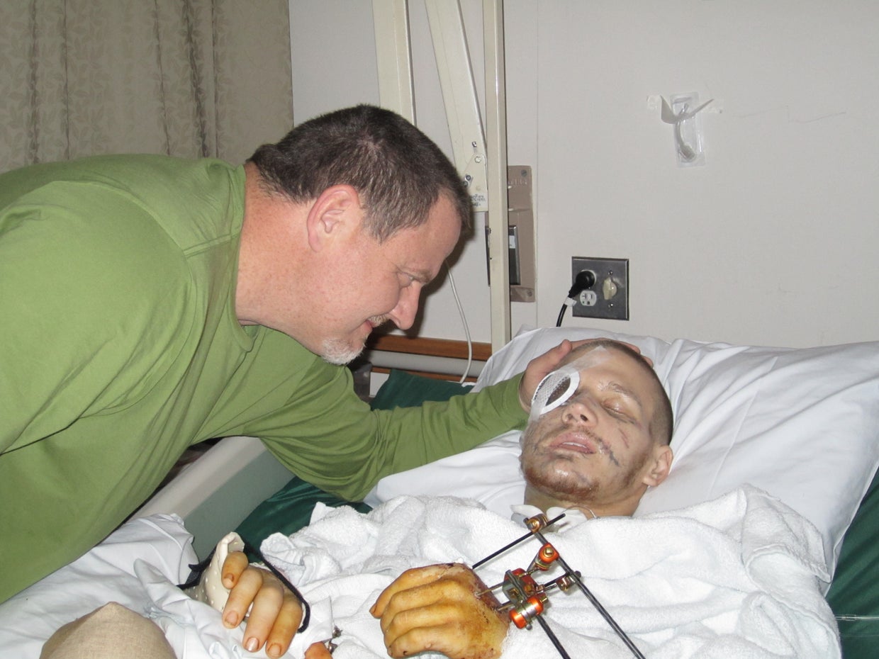 Obama awards Medal of Honor to Marine Kyle Carpenter - CBS News