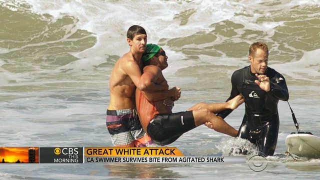 Shark attacks (WARNING: GRAPHIC IMAGES)