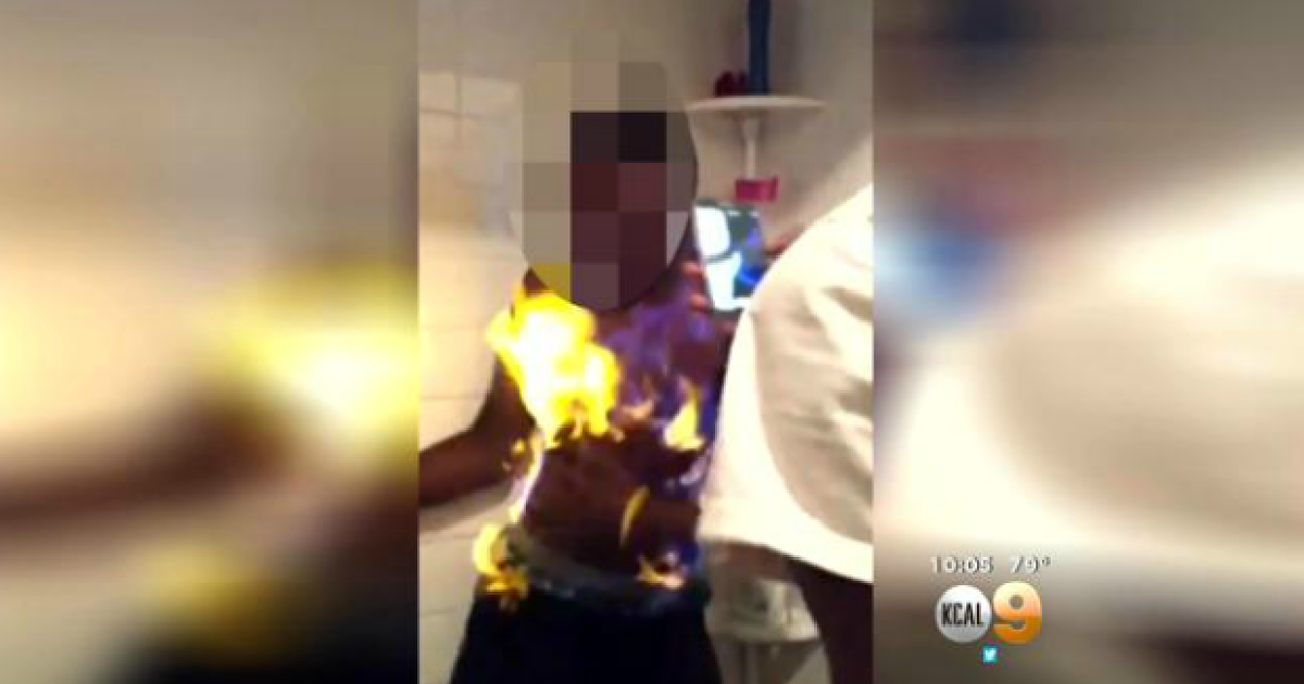 "Fire challenge": California boy sets himself on fire in online dare ...