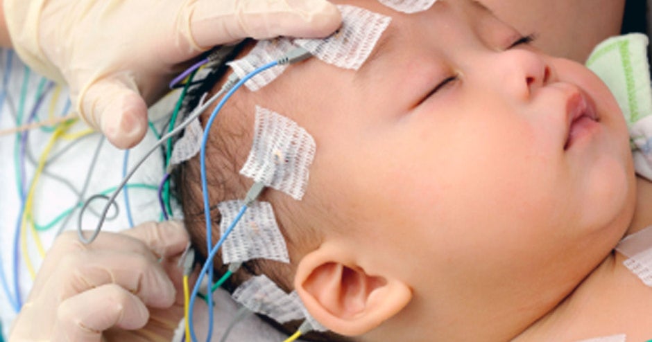 EEG brainwave test may help diagnose autism - CBS News