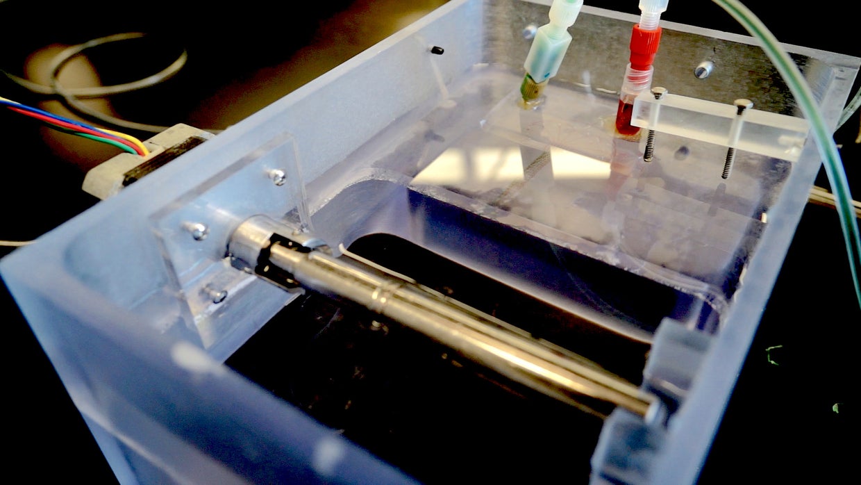 Photos: 3D printing and the future of burn treatment