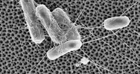 Scientists developing Teflon for bacteria - CBS News