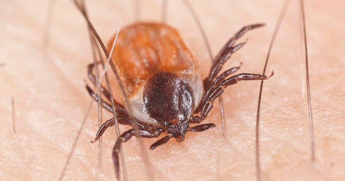 Lyme disease more widespread, costly than previously thought - CBS News