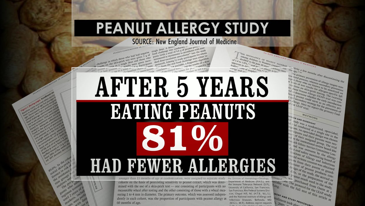 Exposing infants to peanuts lowers risk of allergy, says study - CBS News