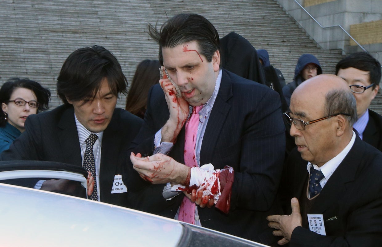 U.S. ambassador to South Korea hospitalized after attack - CBS News