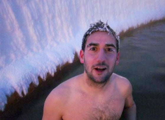 Canada's crazy frozen hair contest in Takhini Hot Springs