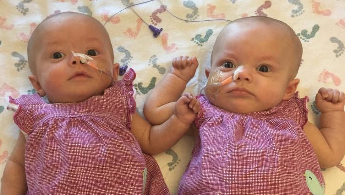 Identical twin girls, Kenedi and Kendal Breyfogle, fighting same cancer ...