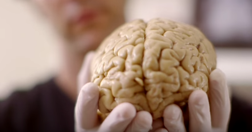 Your brain is your fingerprint - CBS News