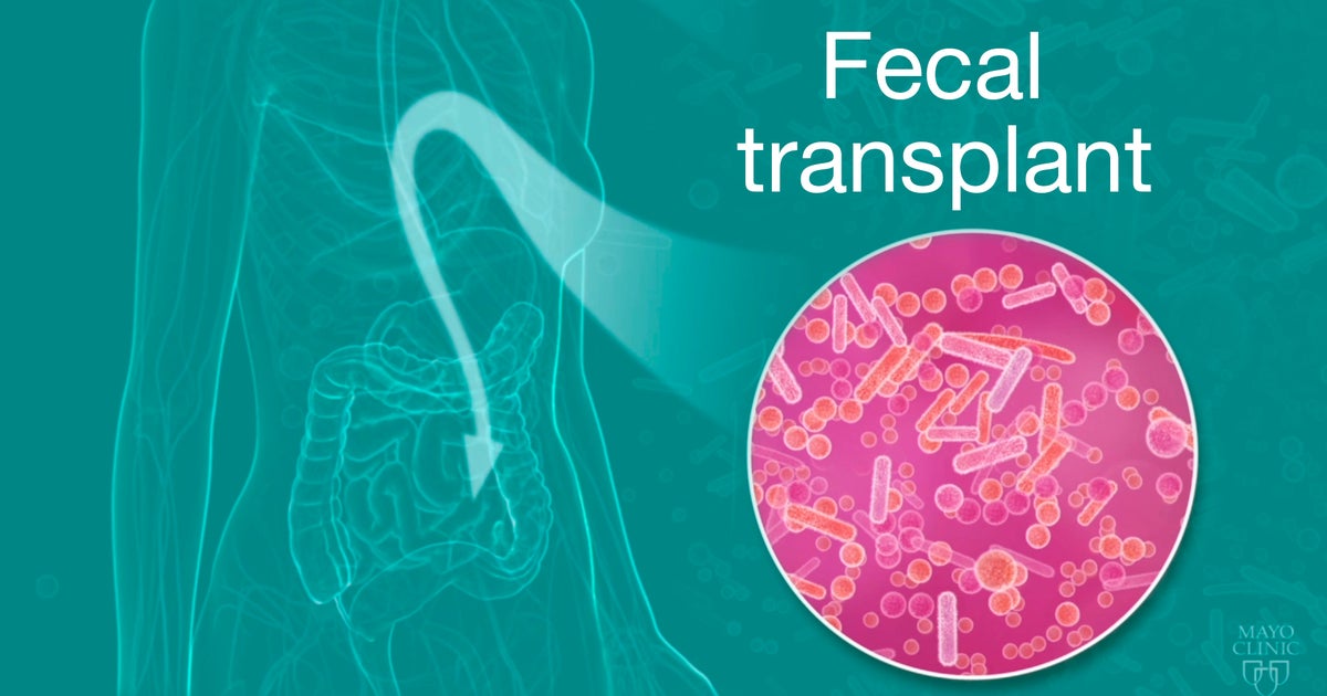 Fecal transplants need better regulation, experts say - CBS News
