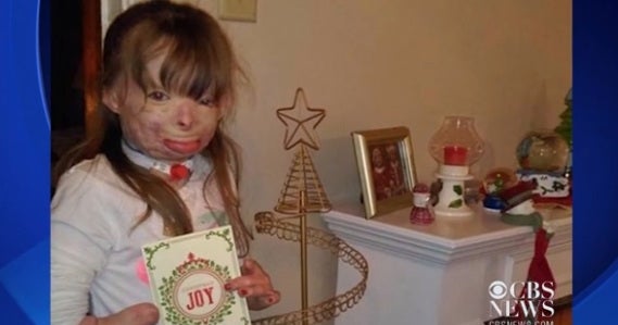 Safyre Terry, who lost family in fire, spreads holiday cheer after ...