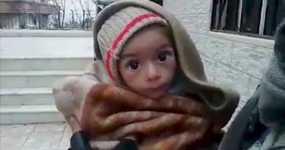 "Starvation as a weapon of war" in Syria