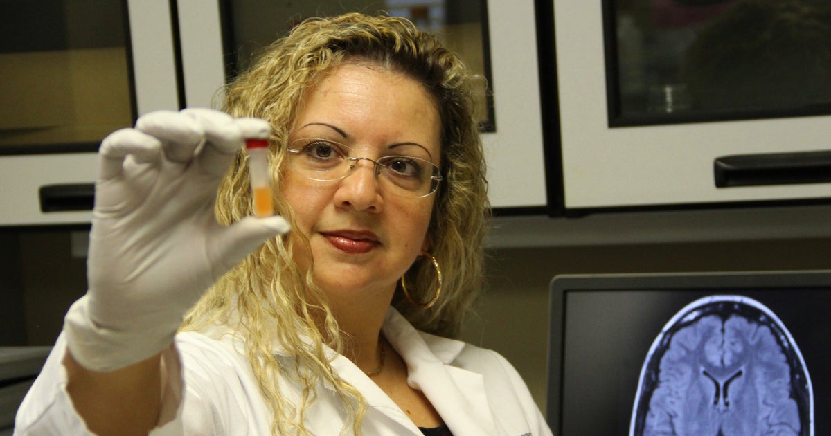 Blood test can detect concussions even days later - CBS News