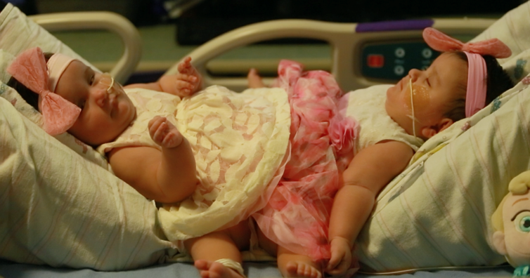 Conjoined Texas Twins Ximena And Scarlett Hernandez Torres Get Set