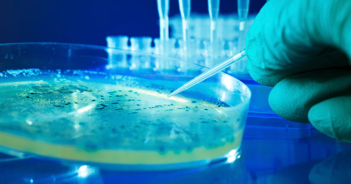 Studying poop samples, scientists find clues to health and disease ...