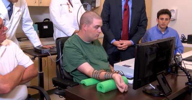 Paralyzed man moves hand with brainwave breakthrough - CBS News