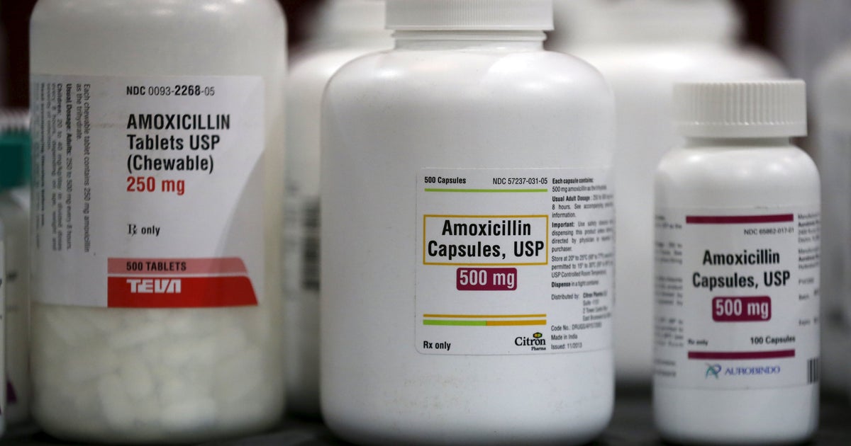 U.S. doctors still overprescribing drugs like antibiotics - CBS News