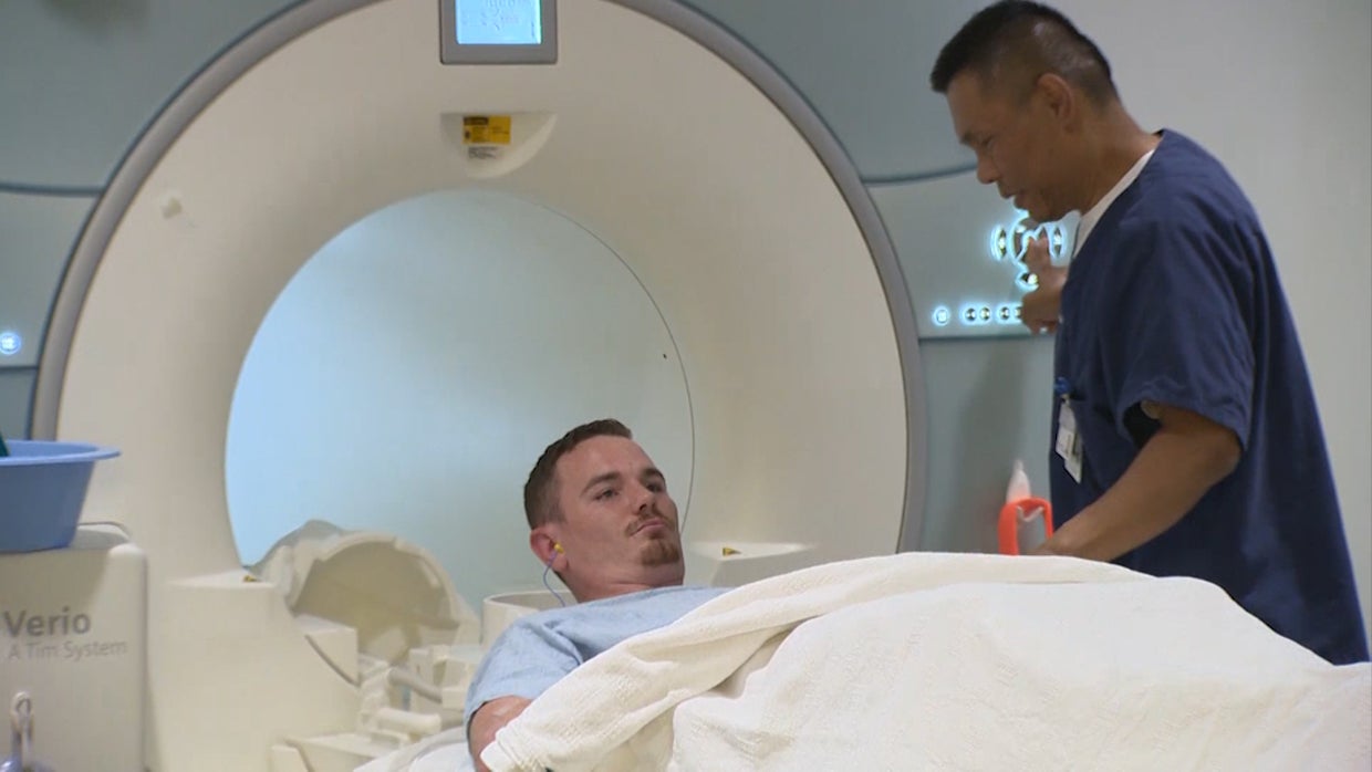 Study looks at what boxing, MMA fighting may do to the brain - CBS News