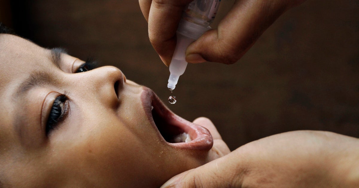 Strain of polio virus found in sewage water in Indian city - CBS News