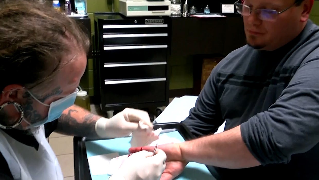 Meet the humans with microchips implanted in them - CBS News