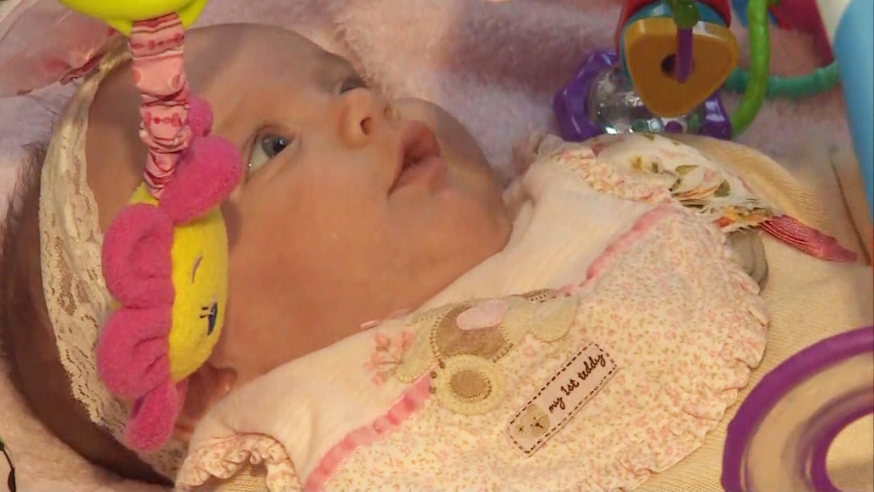 Baby “born twice” after life-saving surgery outside of womb - CBS News