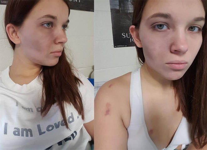 Rise in hate crimes following Trump's election win