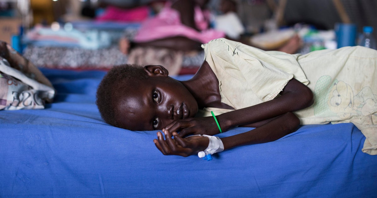 Millions urgently need food in South Sudan's famine - CBS News