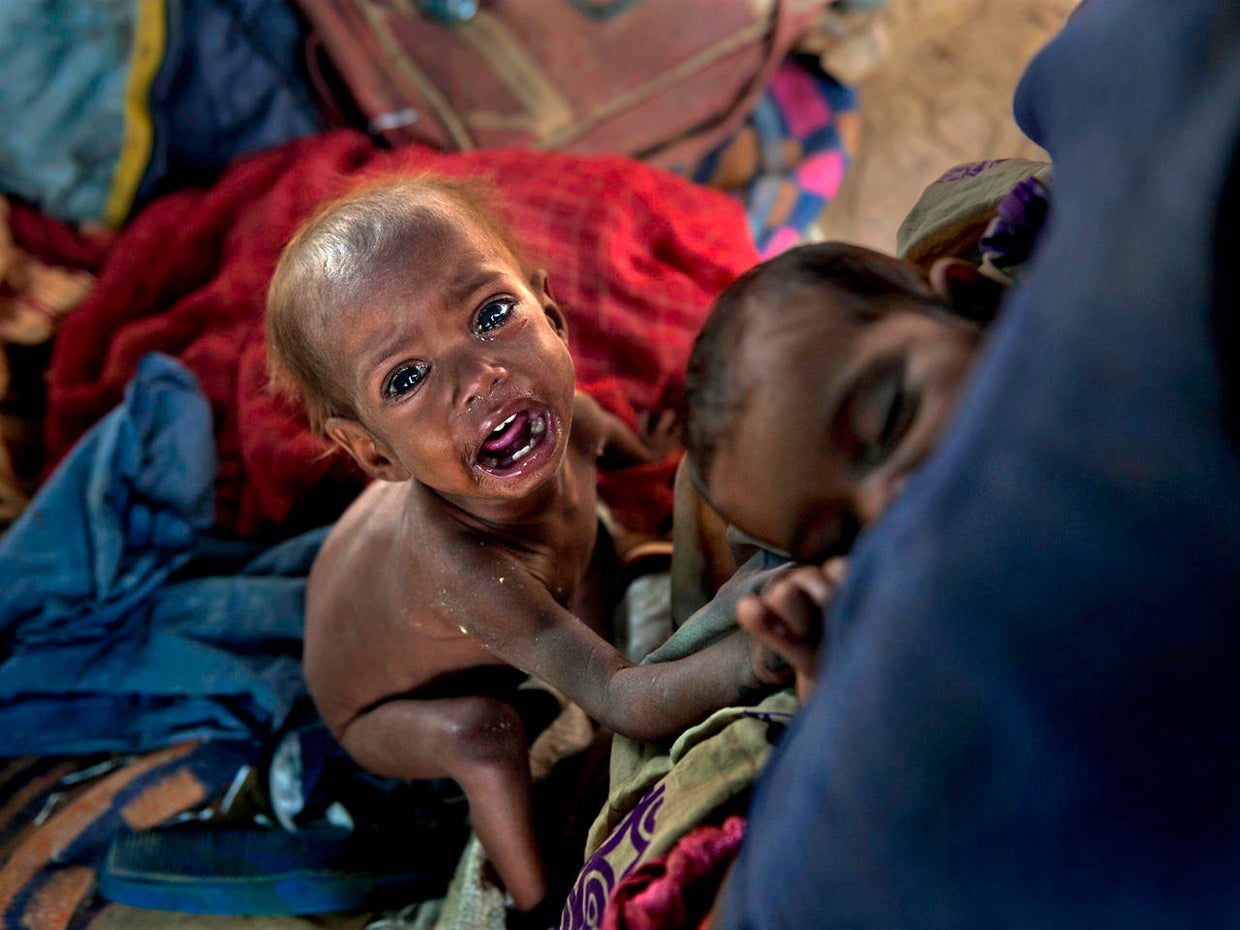Faces of the world's extreme poor
