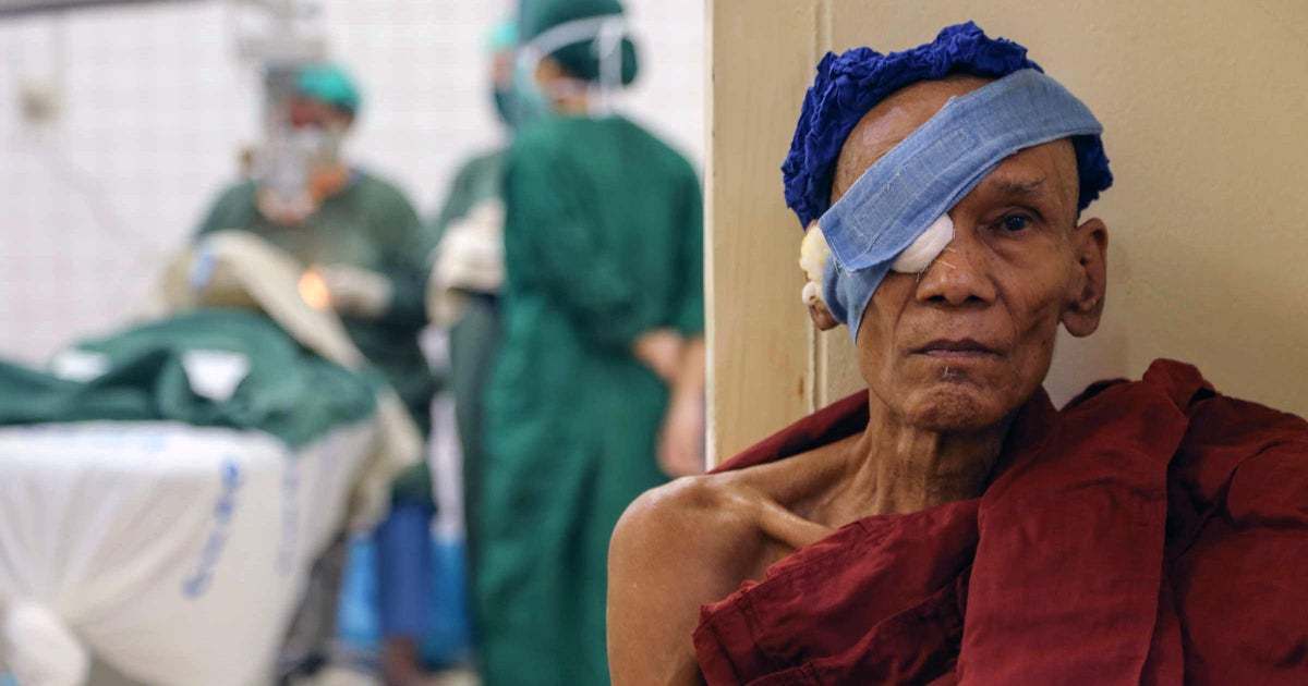 Restoring eyesight with a simple, inexpensive surgery - CBS News