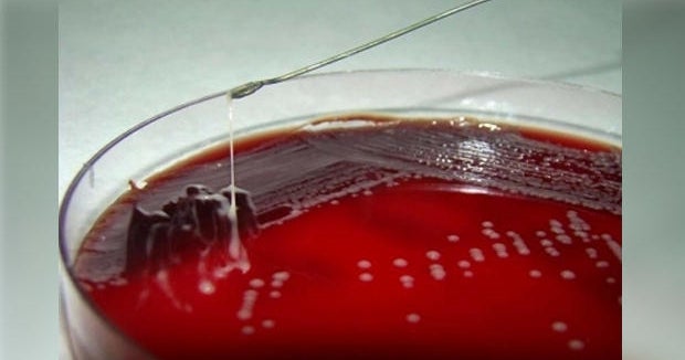Rare superbug strain found in Houston - CBS News