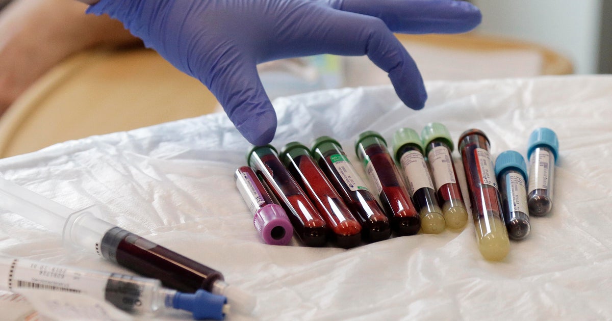 Gene therapy treatment for lymphoma blood cancer wins FDA approval ...