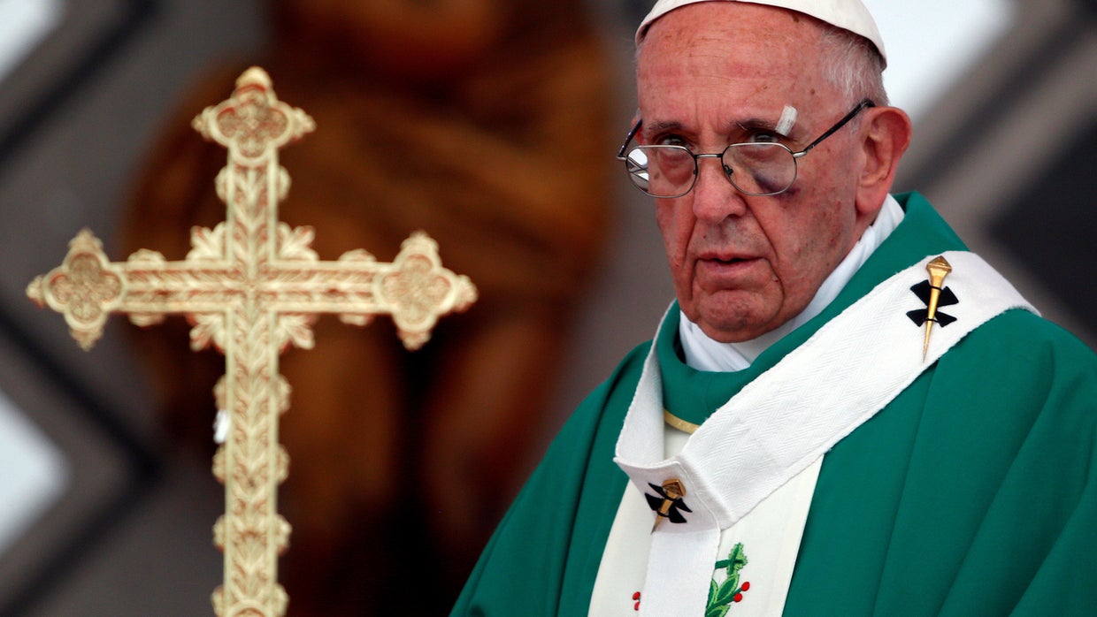 Pope Francis black eye caused by popemobile stopping short to avoid ...