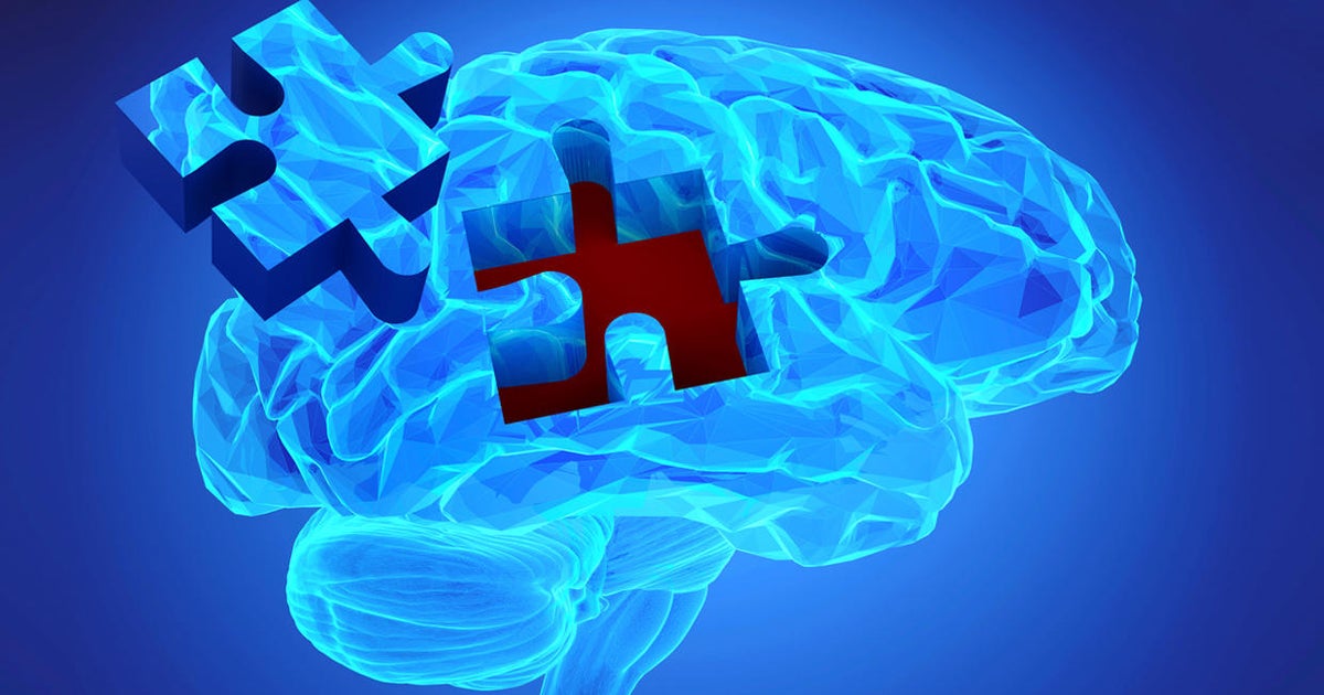 BrainHQ brain-training program may help ward off dementia, study finds ...