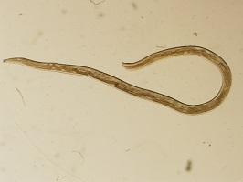 Oregon woman infected with rare "eye worm" - CBS News