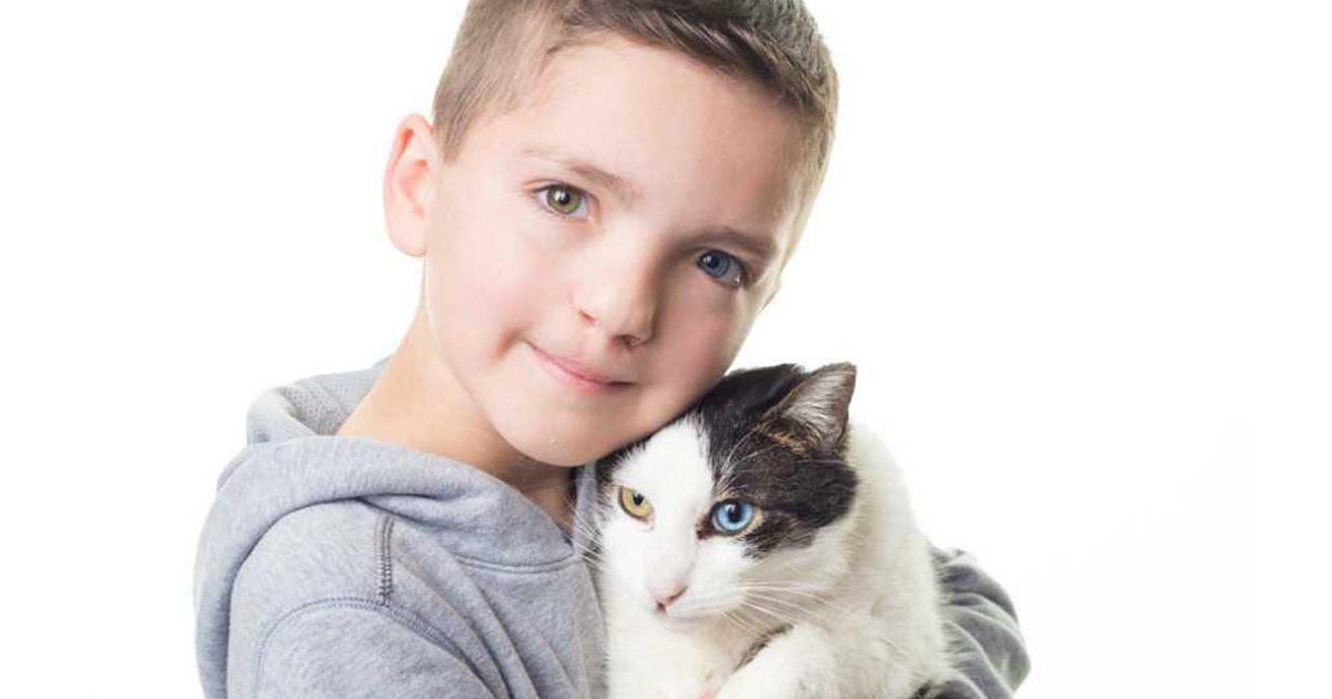 Bullied boy rescues cat with same rare eye condition and cleft lip ...
