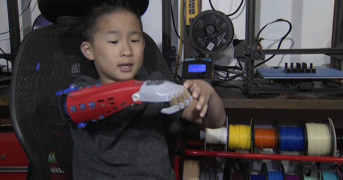 Boy missing part of his arm gets 3-D printed "upgrade" - CBS News