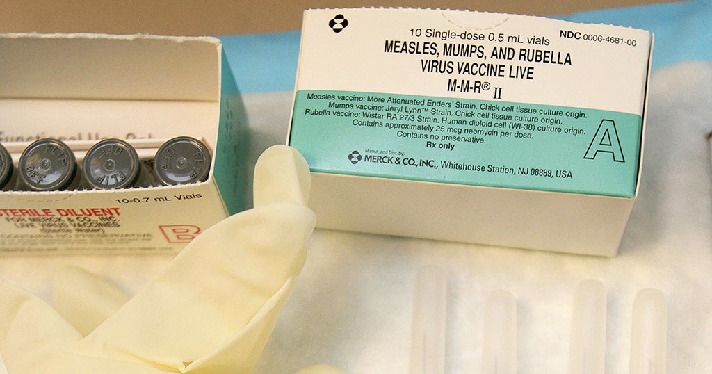 The Measles - Are You Protected? - CBS Boston