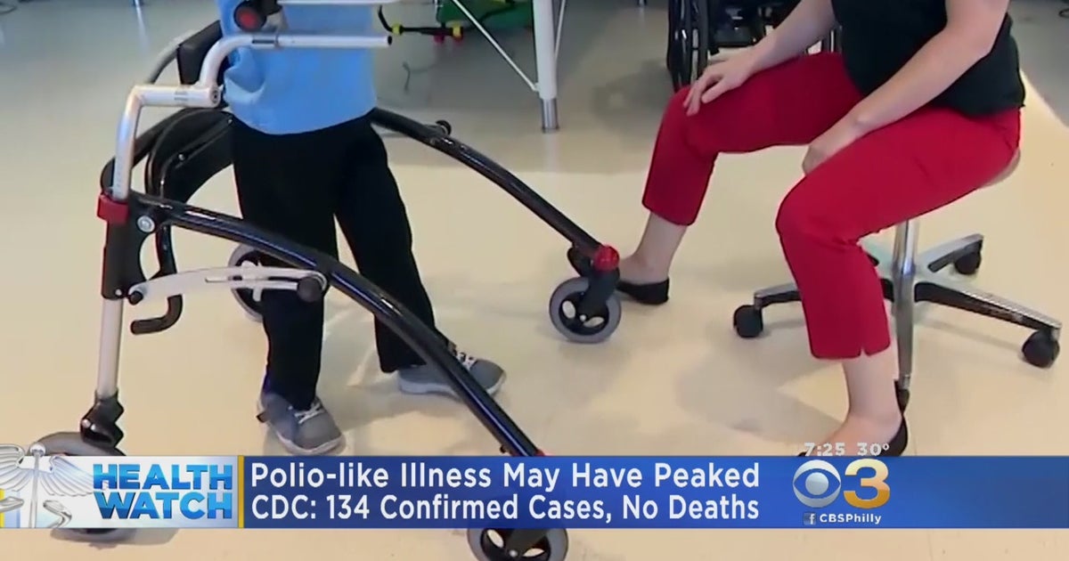 Health Officials: Polio-like Illness May Have Peaked - CBS Philadelphia