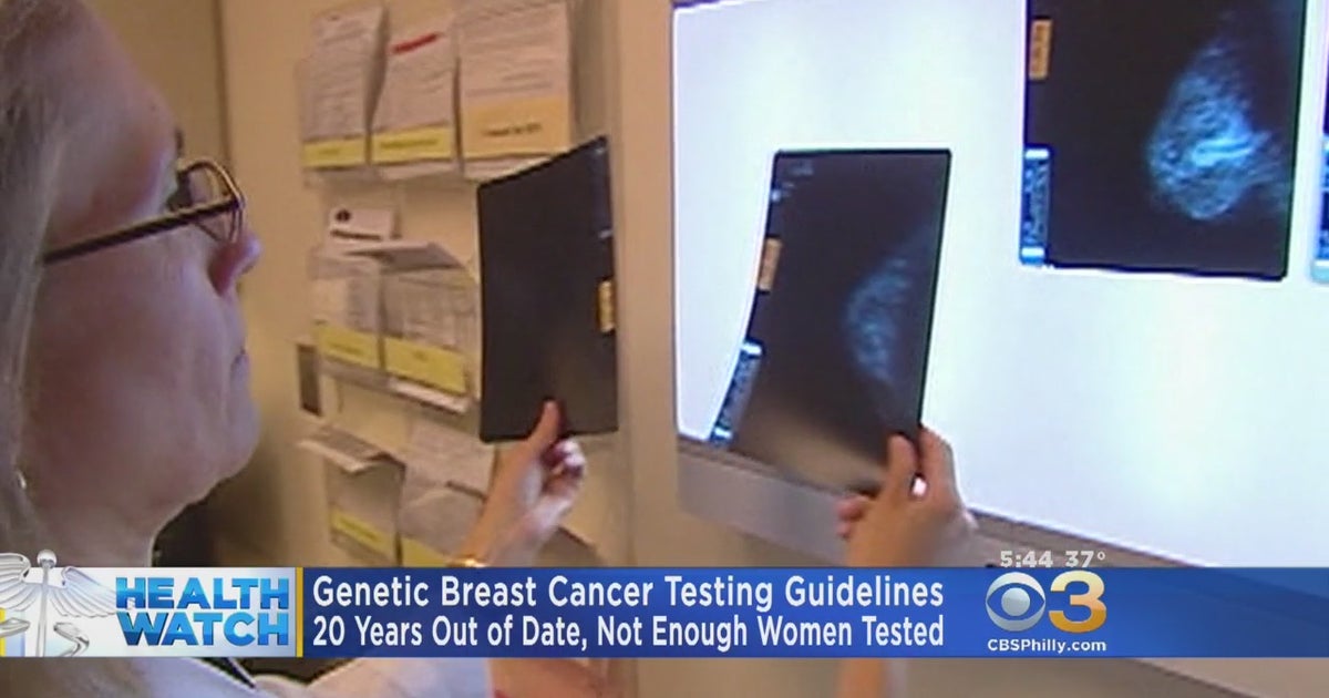 Study: Breast Cancer Testing Guidelines 20 Years Out Of Date - CBS ...