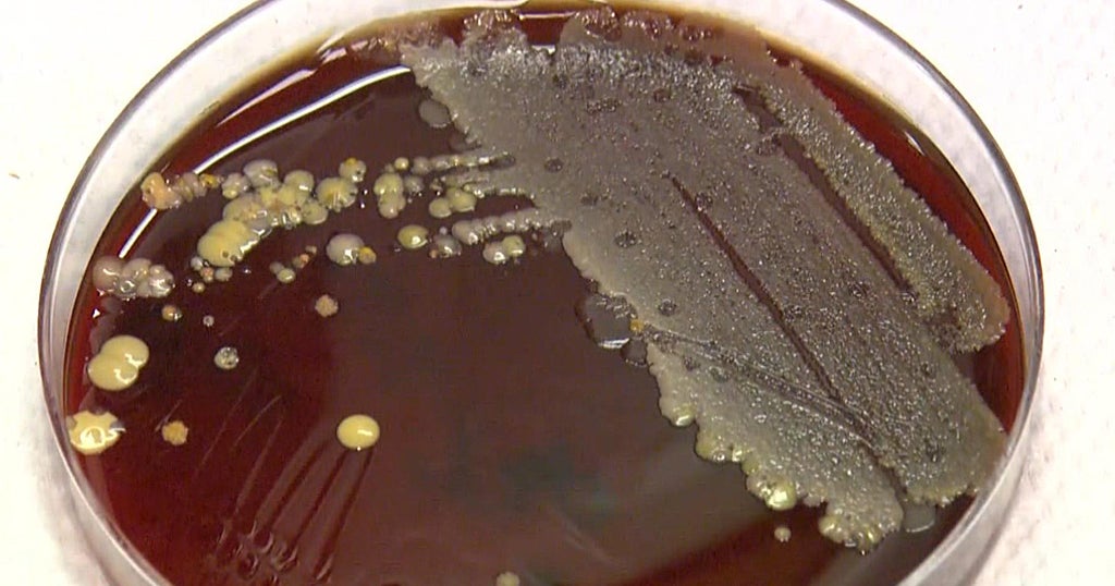 The Bacteria In Your Nose Could Protect You From The Flu - CBS Boston