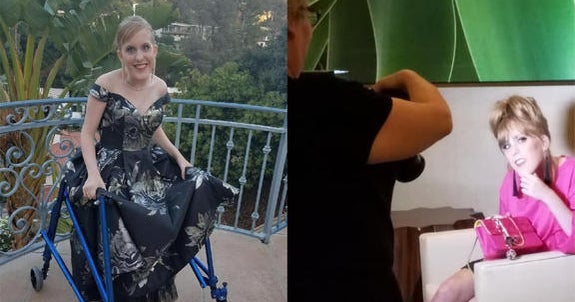 Model with cerebral palsy on a mission to inspire others - CBS News