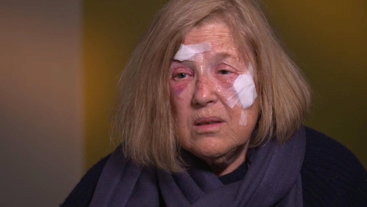 Sausalito mudslide: Susan Godon buried alive, rescued gives interview ...