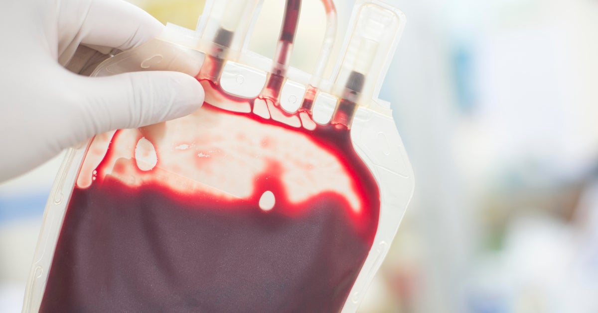 Startup halts treatment using young people's blood after FDA warning ...