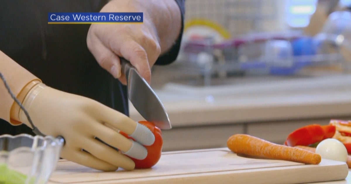 Researchers Work To Bring Sense Of Touch To Prosthetic Devices - CBS ...